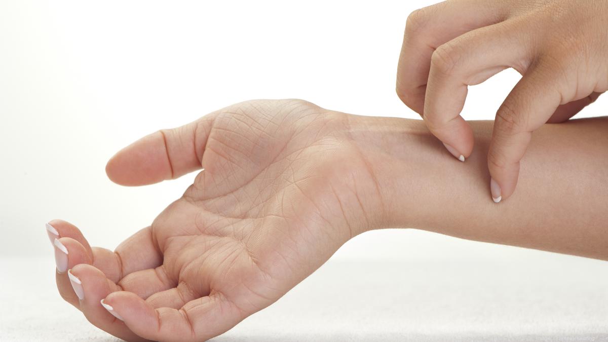 Be alert to workers’ skin issues caused by chemical exposure - The ...