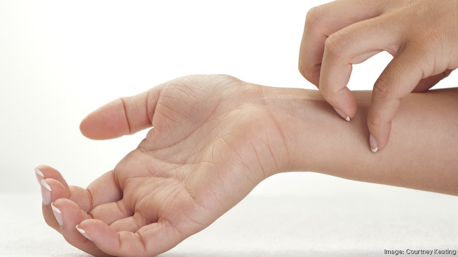Be alert to workers’ skin issues caused by chemical exposure - The ...