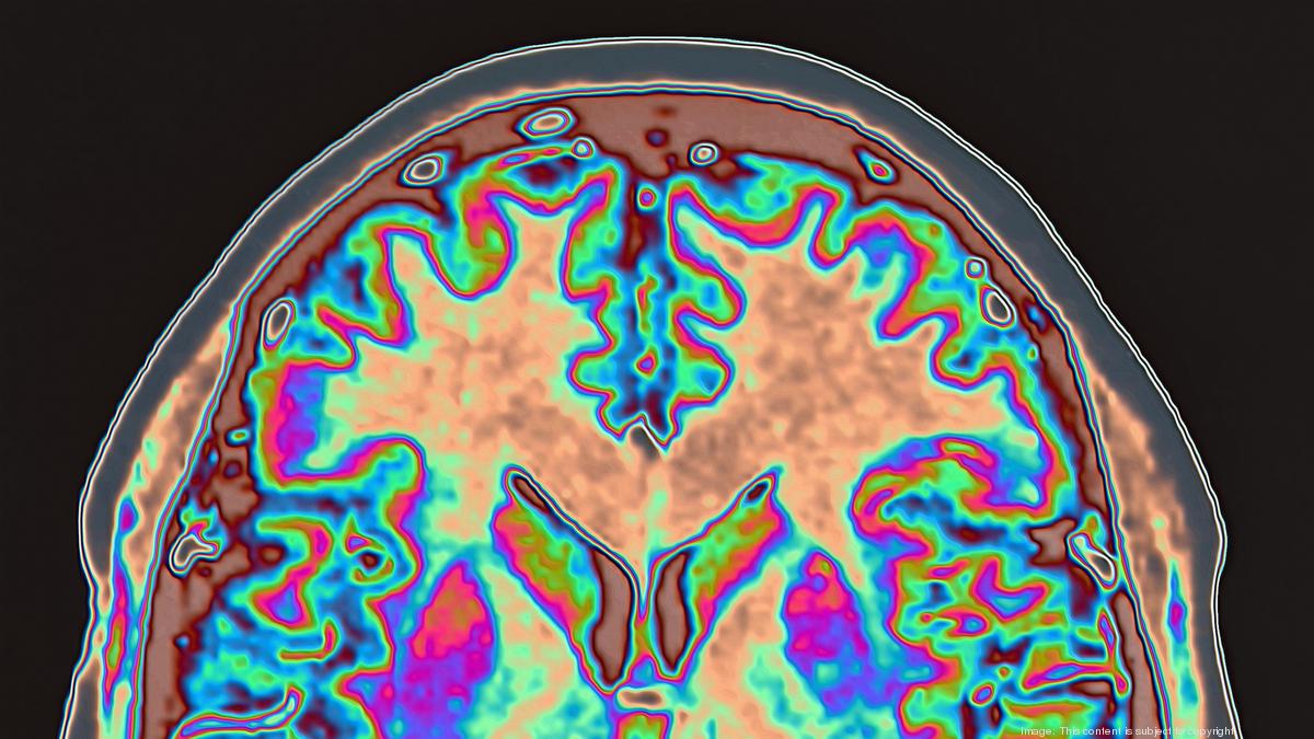 Framingham biotech Alzheon files for $81M IPO, plans Phase 3 trial of ...