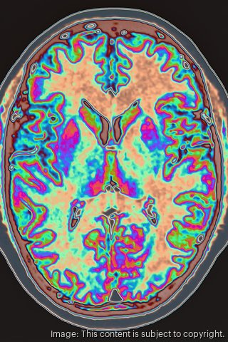 OHSU study finds people of color twice as likely to die after traumatic ...