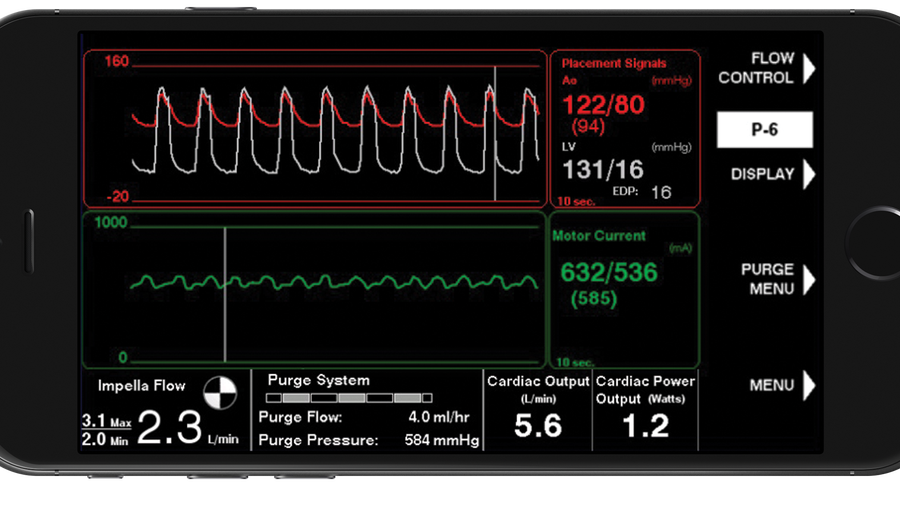 Danvers' Abiomed testing heart pump monitoring system at Beth Israel ...