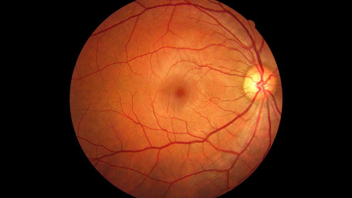 Vitreo-Retinal Consultants: - Wichita Business Journal