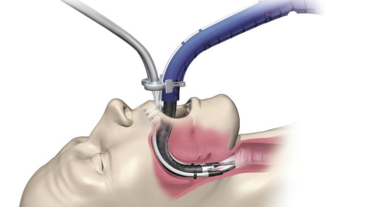 SSM Health SLU Hospital to operate flexible robotic system - St. Louis ...