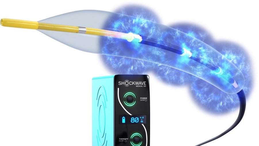 Shockwave Medical scores $97 million in upsized IPO - Silicon Valley ...