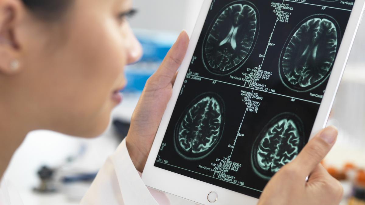Medical imaging firm Intelerad buys Life Image; deal linked to top US ...