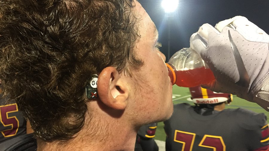 Protxx pivots from sports to medical diagnostics - Sacramento Business ...