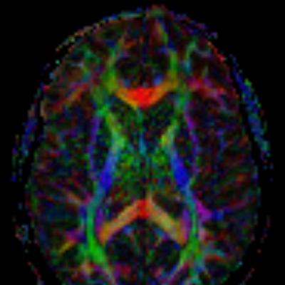 Kids with concussions don't always need CT scans, warns doctor at ...