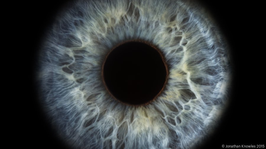 Kodiak Sciences turns down $125M from Baker Bros. Advisors as it pushes ...