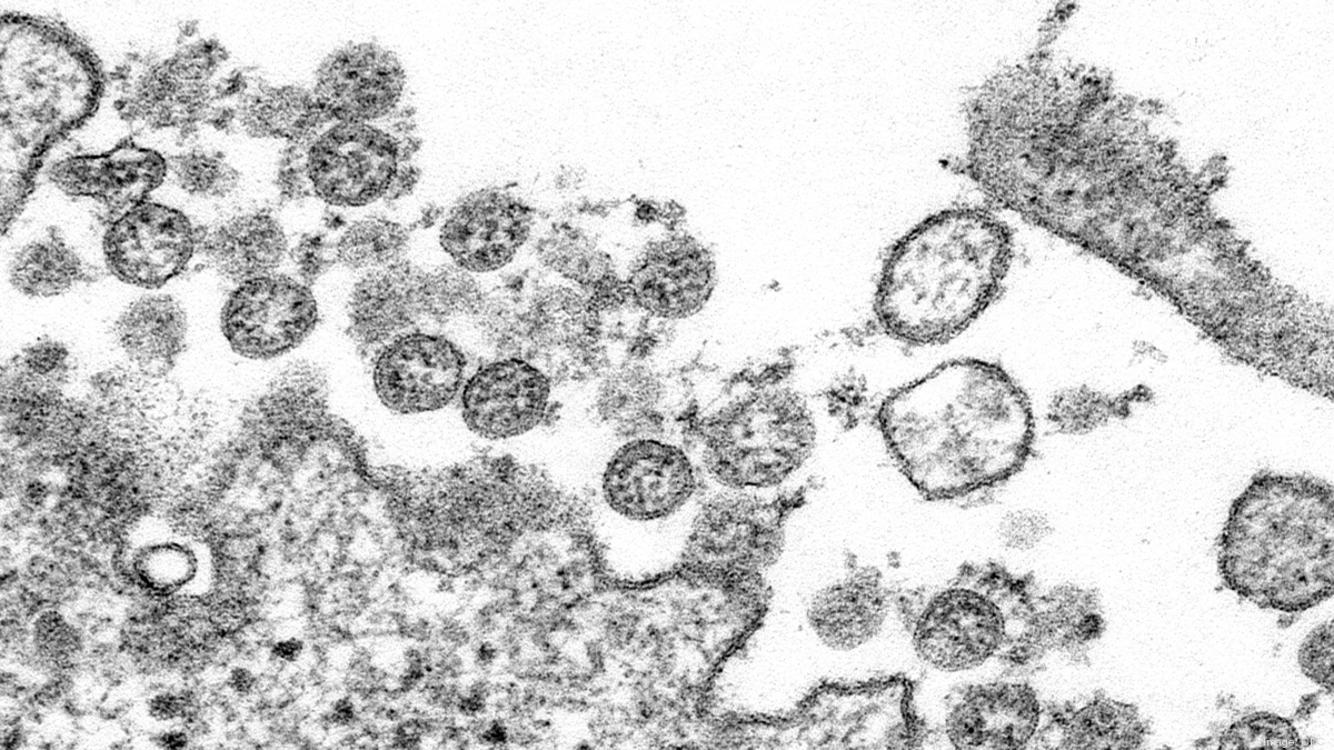 Join Allison DeAngelis for subscriber-only call on COVID-19's biotech ...