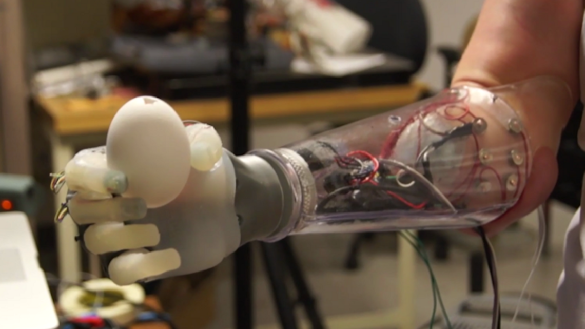 Chicago Inno - This UIUC Entrepreneur Invented an Affordable Bionic Hand