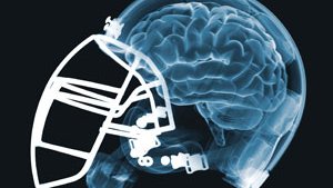 Harvard Medical School & NFL Players Association Partnership - Boston ...