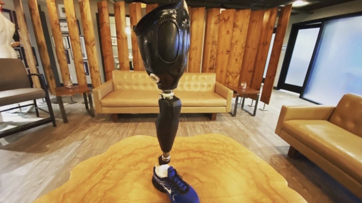 Childhood injury inspired entrepreneur to create Limb Lab in Rochester ...