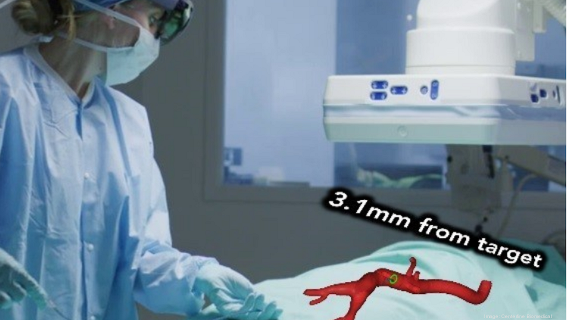 Cleveland Inno - Centerline Biomedical, the Cleveland medical ...