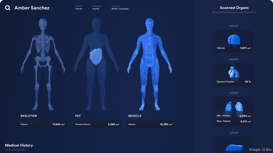 Kaiser Permanente invests in full-body scan technology company Q Bio ...