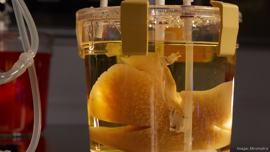 Miromatrix Medical acquired by United Therapeutics - Minneapolis / St ...