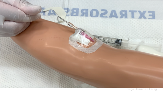 Albany Inno - The Pitch: Albany medical device startup's idea is tiny ...