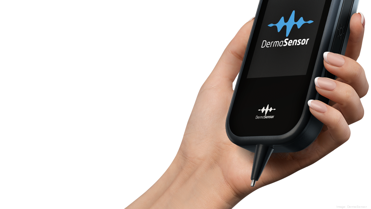 DermaSensor's handheld device can detect skin cancer with 97% accuracy ...
