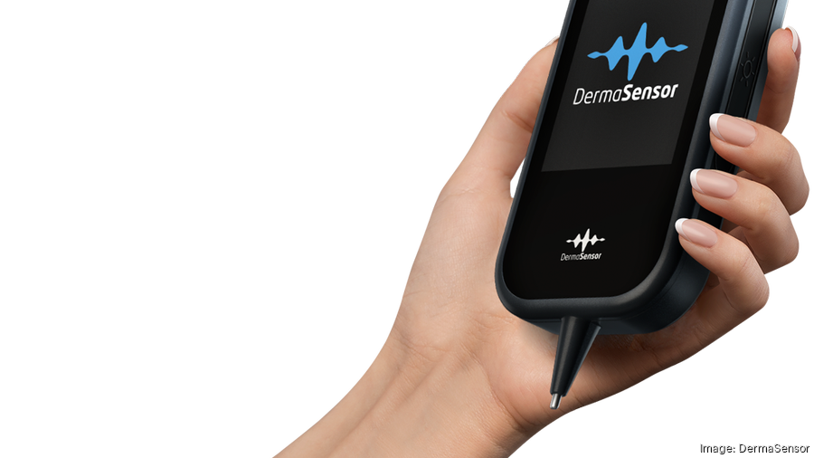 DermaSensor's handheld device can detect skin cancer with 97% accuracy ...