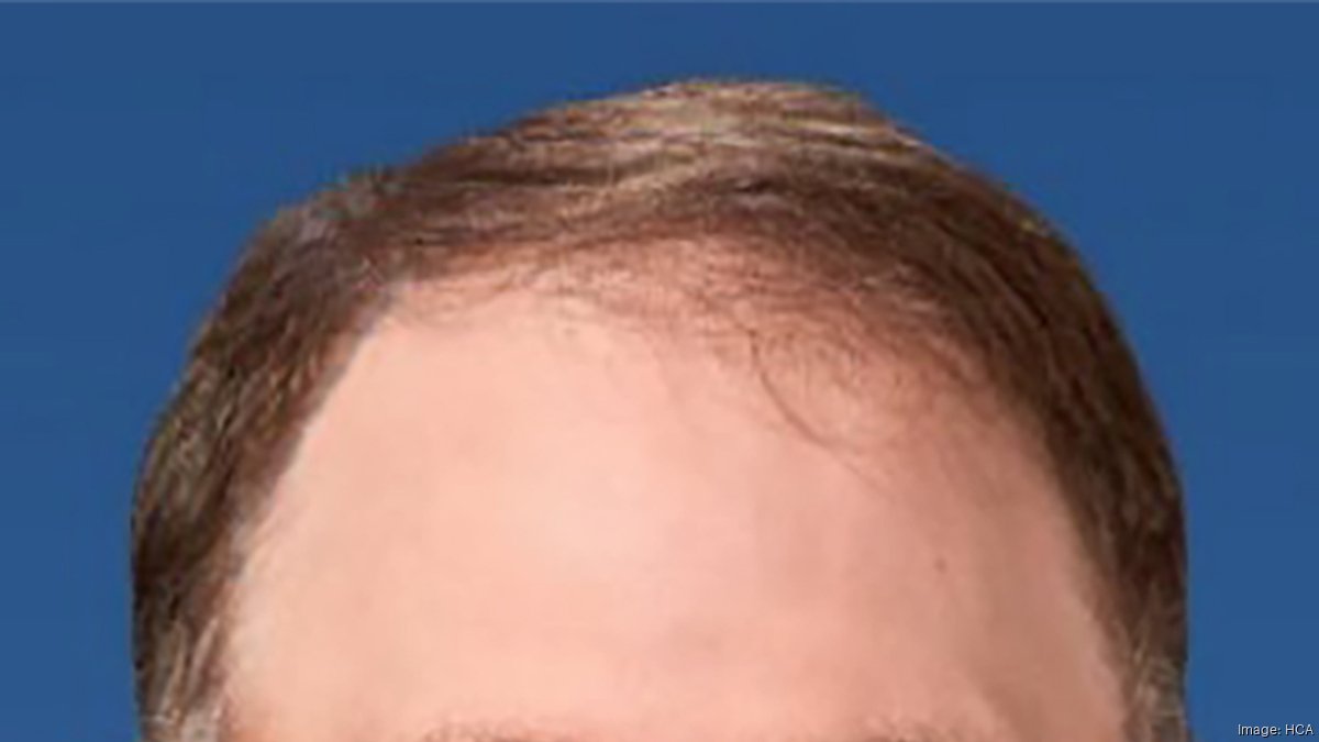 HCA Florida Memorial Hospital CEO Brad Talbert to lead Georgia facility ...