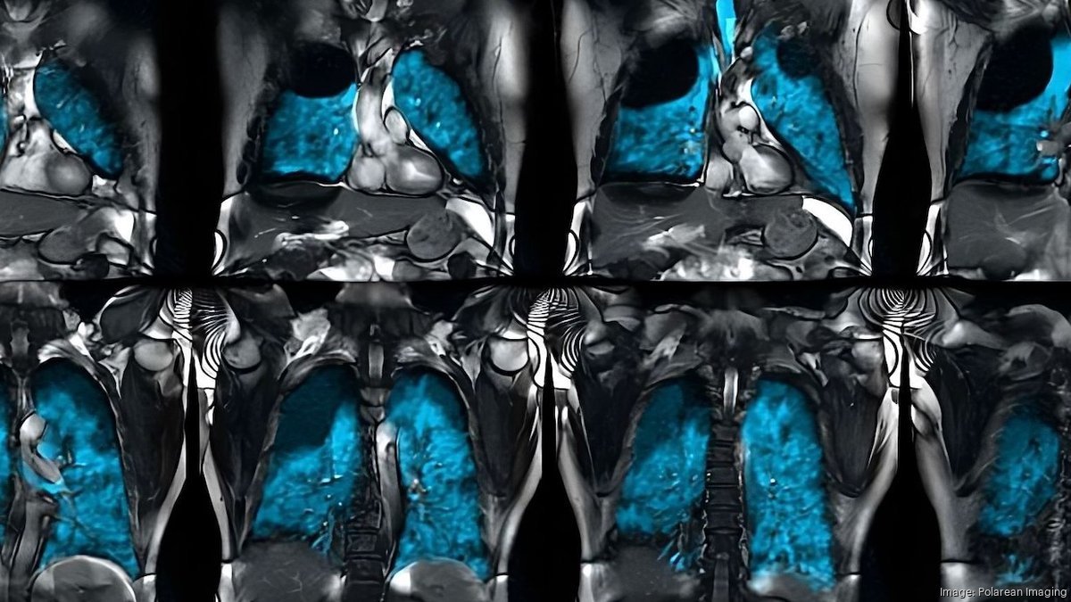 Polarean Imaging delists from London Stock Exchange - Triangle Business ...
