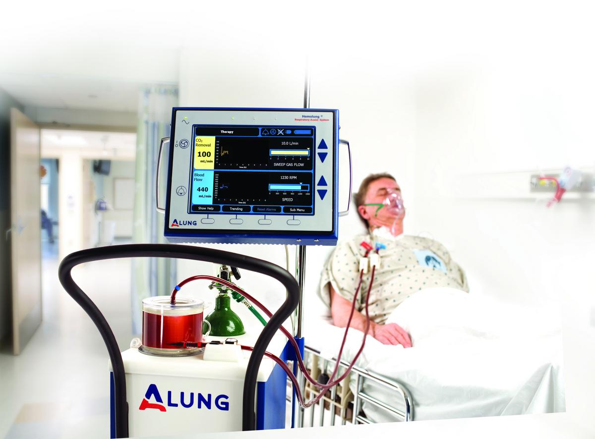 ALung looking to the Chinese market - Pittsburgh Business Times