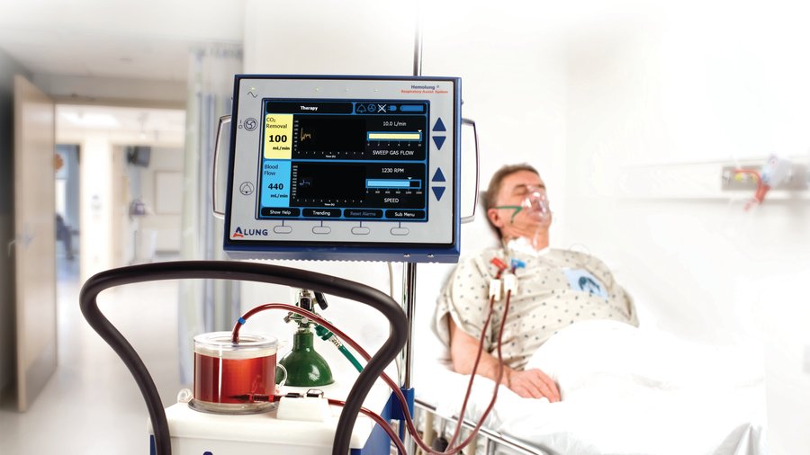 ALung hits enrollment record for clinical trial of artificial lung ...
