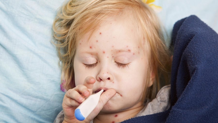 New York Times: How Arizona’s measles outbreak became largest in U.S ...