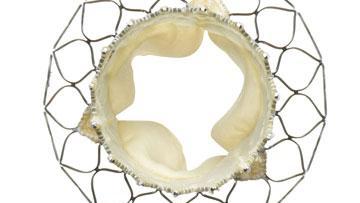 Court: Medtronic can sell CoreValve device for now - Minneapolis / St ...