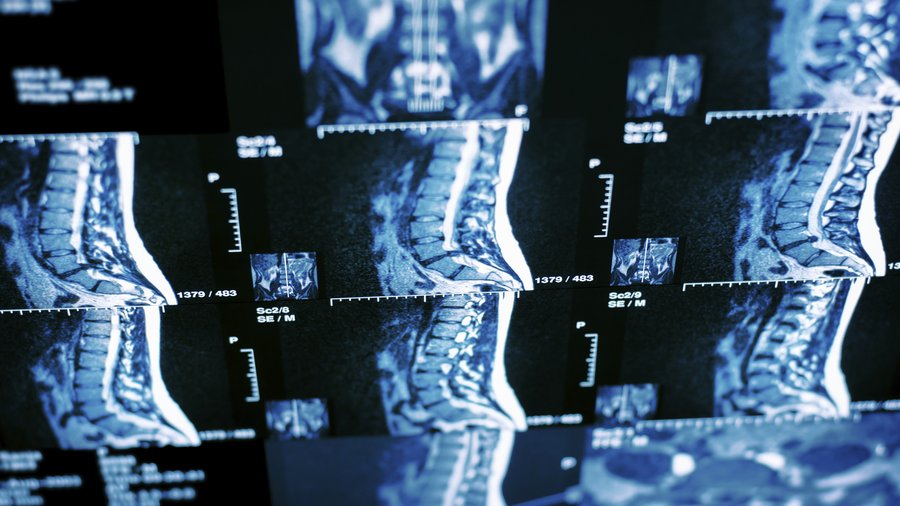 Bone-graft startup Fortus Medical raises capital - Minneapolis / St ...