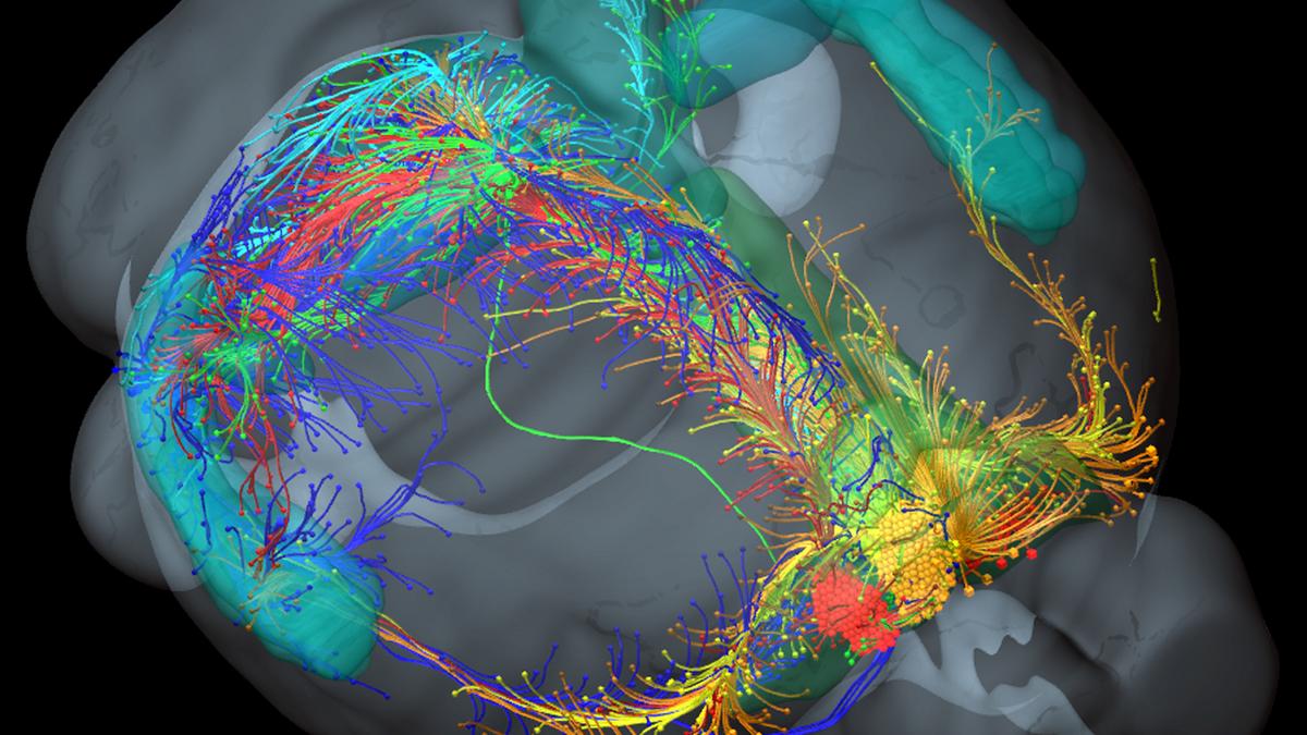 Allen Institute for Brain Science wins $3.4M for Alzheimer’s research ...