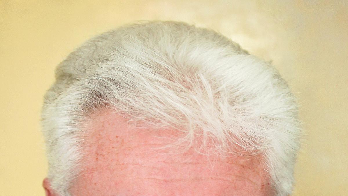 Two competing sides in health reform: jobs vs. innovation - Albany ...