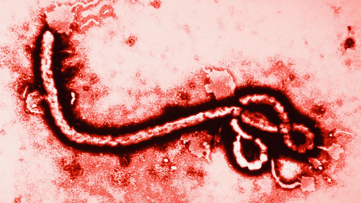 UPDATED: Stanford ER surgeon being monitored for Ebola by San Mateo ...