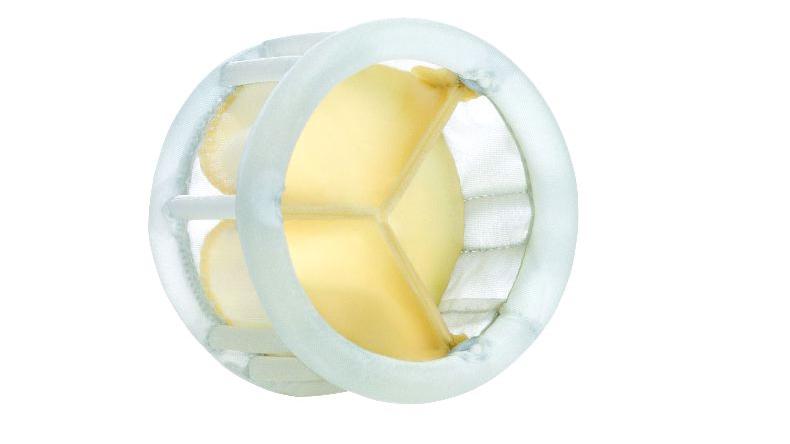 Direct Flow Medical heart valve device wins approval in Europe - San ...