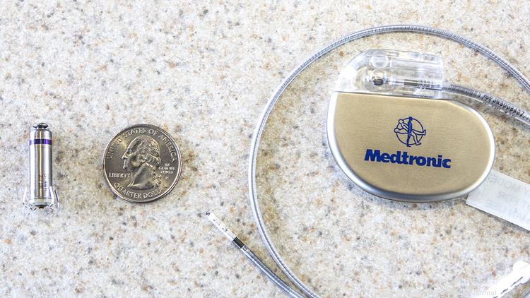 Jacksonville patients are part of a test of the world's smallest ...