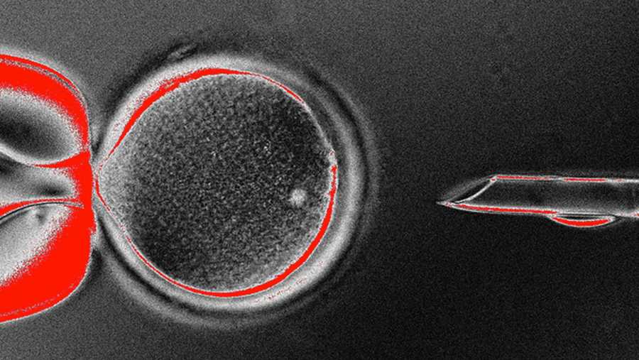 Cellular Dynamics issued patent for blood vessel, blood cell technology ...