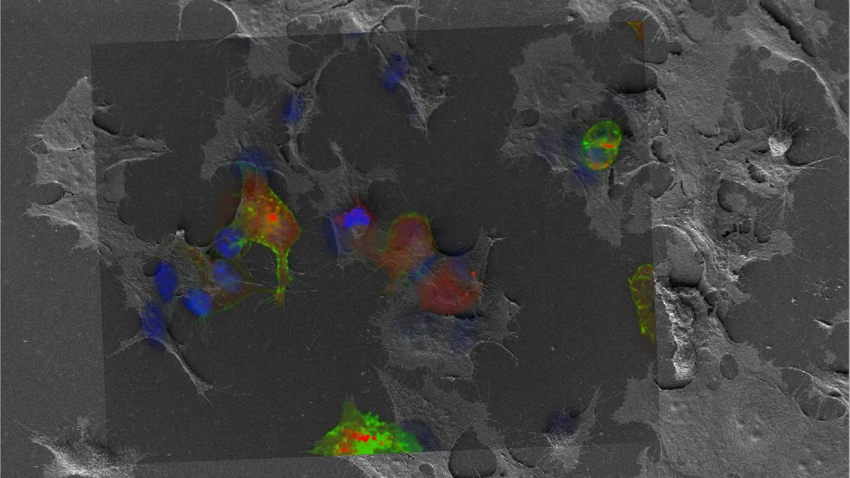 A $1M microscope — designed in Oregon — helps OHSU see living cancer ...