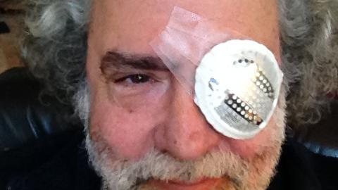 Ed Goldman: Viewing a PowerPoint before cataract surgery is recommended ...