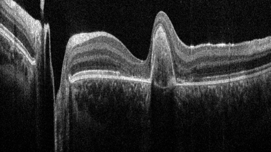 Morrisville-based Bioptigen Inc. acquired by Leica Microsystems ...