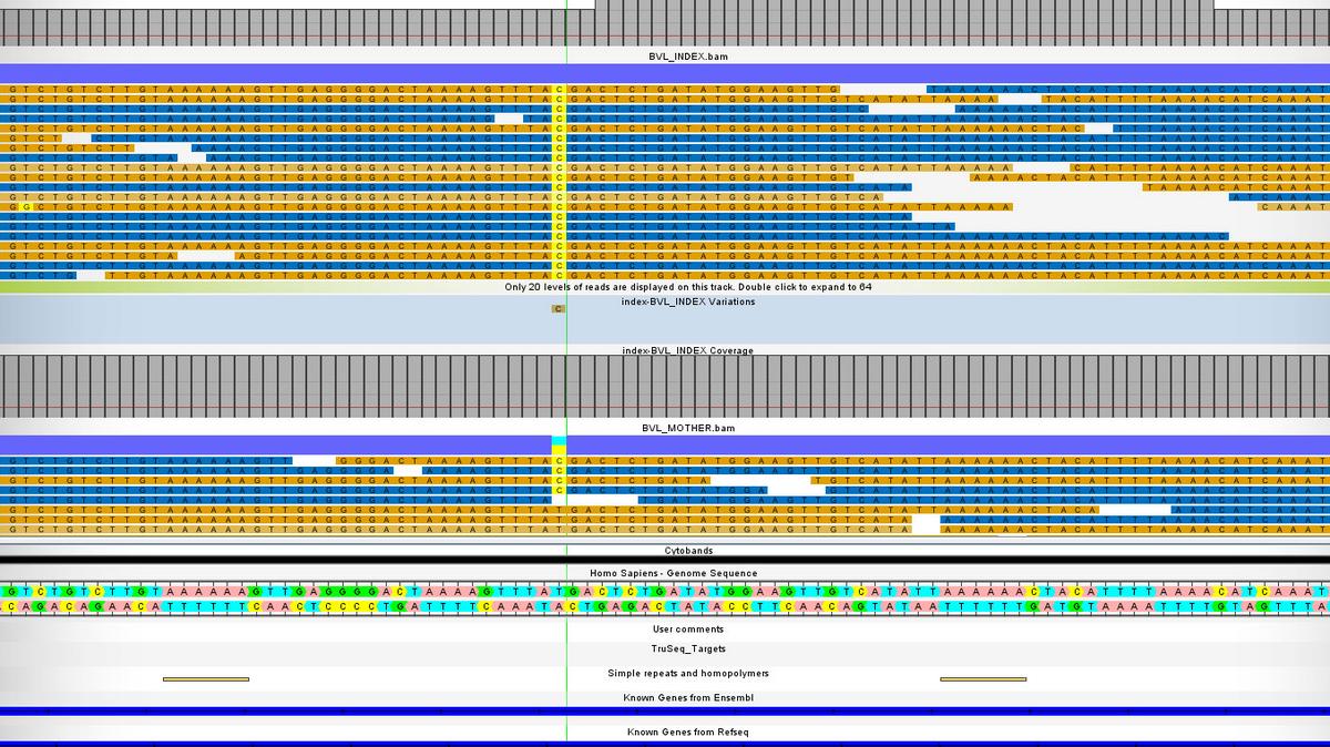 Cambridge company chosen by U.K. to help in giant genetics project ...