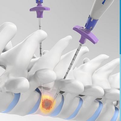 Medtronic buys spine-tumor destroying OsteoCool tech from Baylis ...