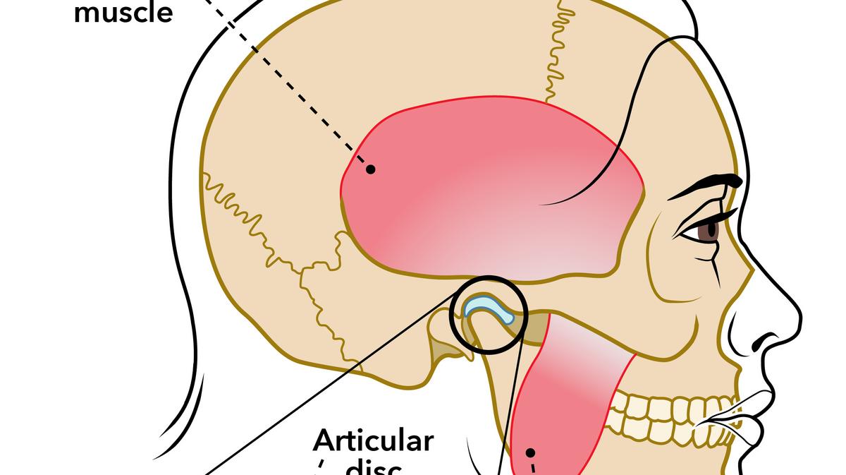 5 symptoms of painful TMJ disorders - San Antonio Business Journal