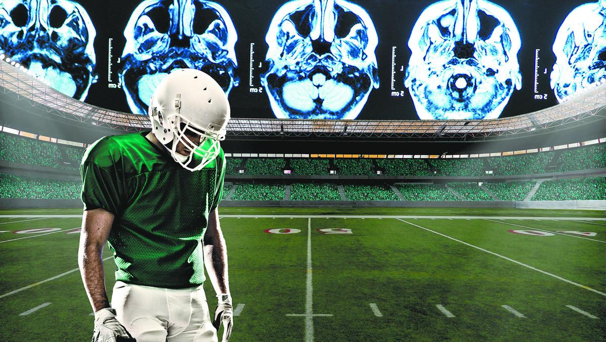 NFL concussion settlement: Judge once again seeks changes - Pittsburgh ...