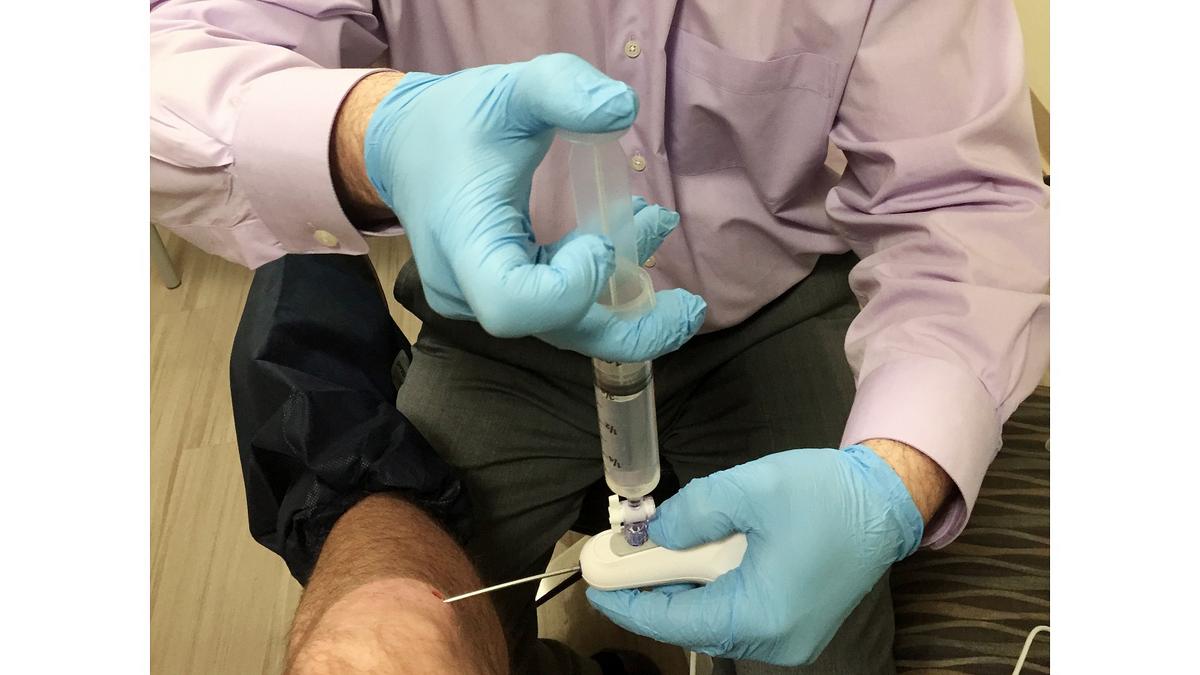 Malvern-based Trice Medical, maker of mi-Eye 2, raises $18.3 ...