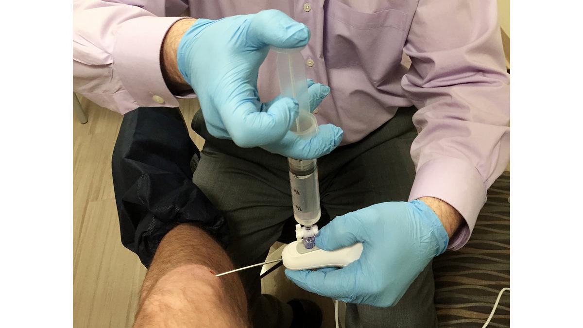 Trice Medical raises $19.3M for national product rollout - Philadelphia ...