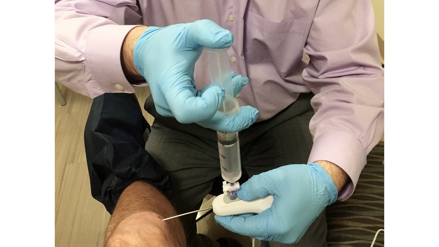 Trice Medical gets FDA approval for Mi-eye 2 - Philadelphia Business ...